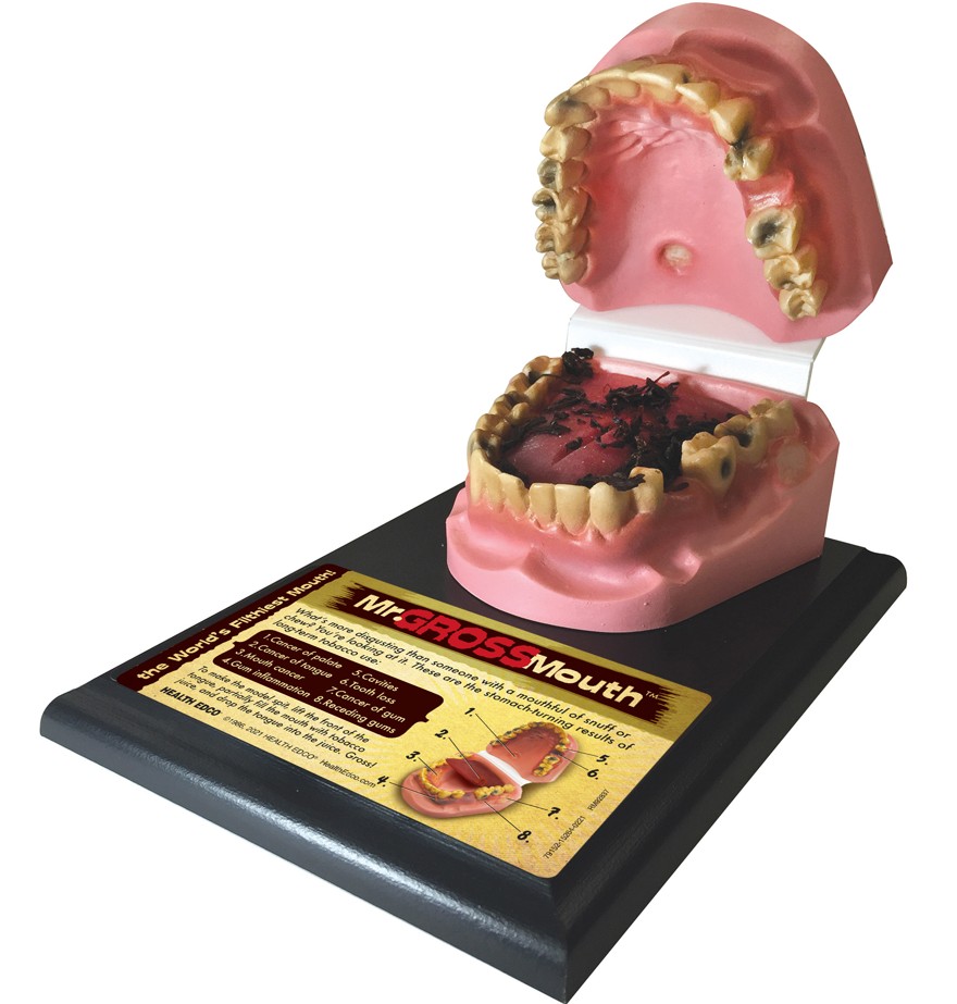 Mr. Gross Mouth Model - Primo Prevention