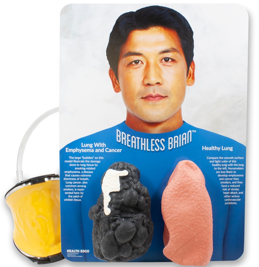 Breathless Brian Smoker's Lungs Comparison Model - Primo Prevention